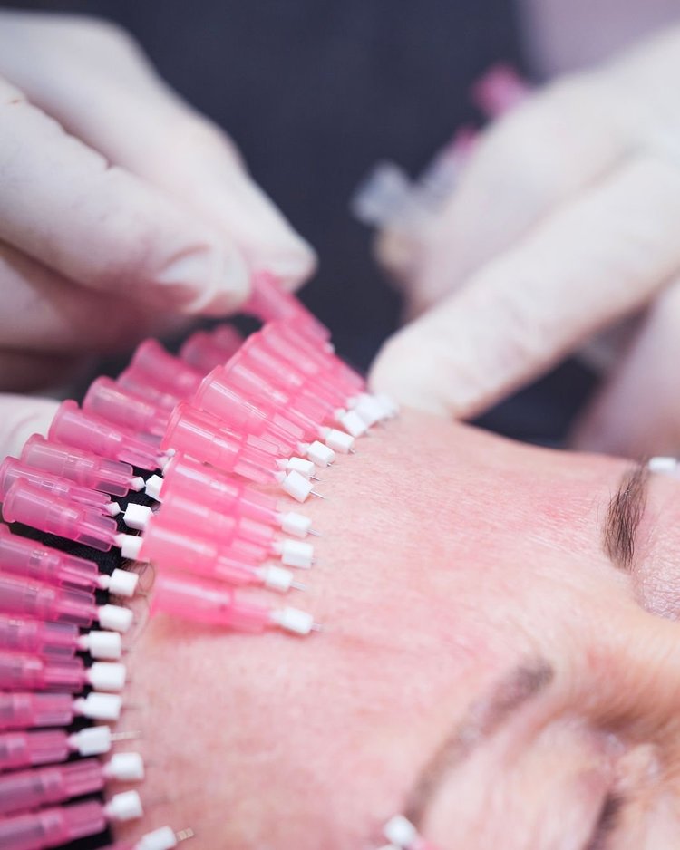 PDO mono threads in Sydney – twandskin